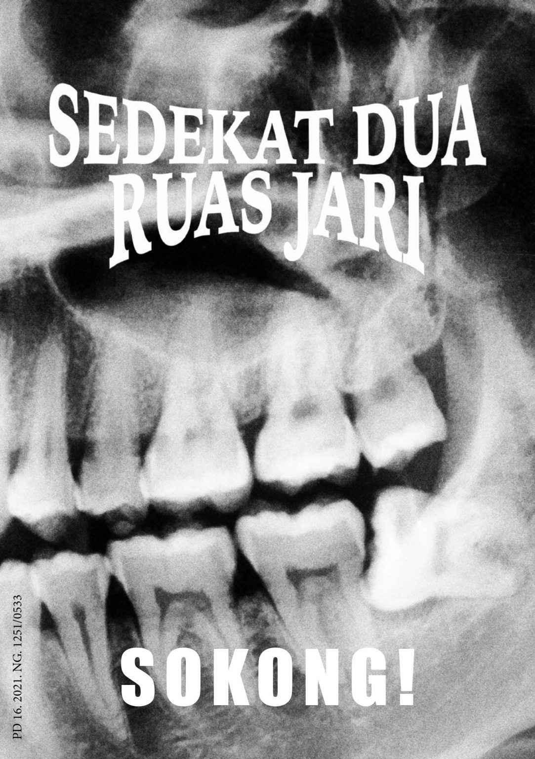 Edisi 16 – Sedekat Dua Ruas Jari – SOKONG!